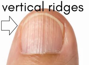 Regular Nail Polish vs Gel: Which is Right for You? - nailhow
